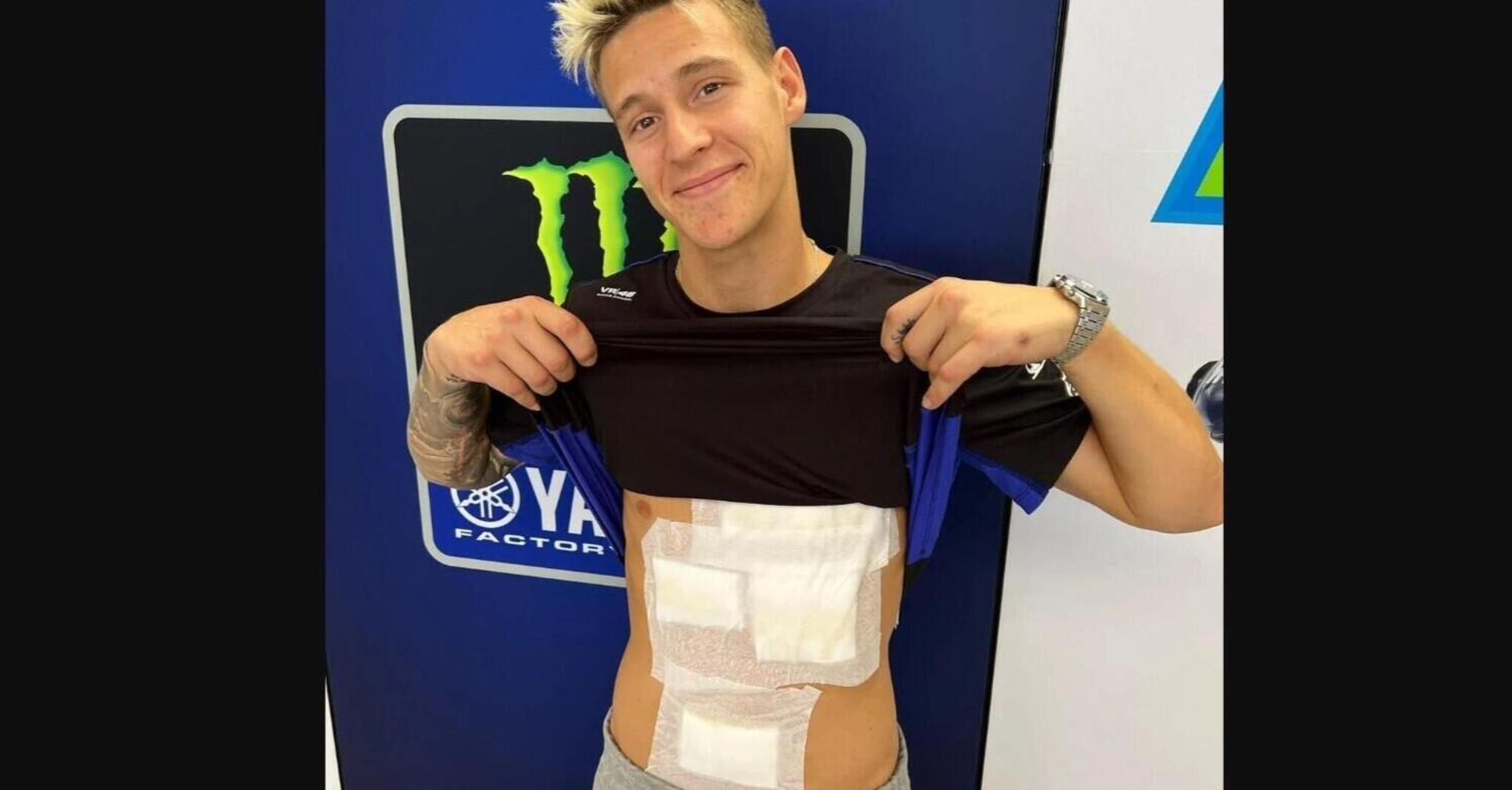 MotoGP 2022. GP di Aragon. La giornata nera di Quartararo: bruciature ... MotoGP 2022. GP di Aragon. La giornata nera di Quartararo: bruciature ...