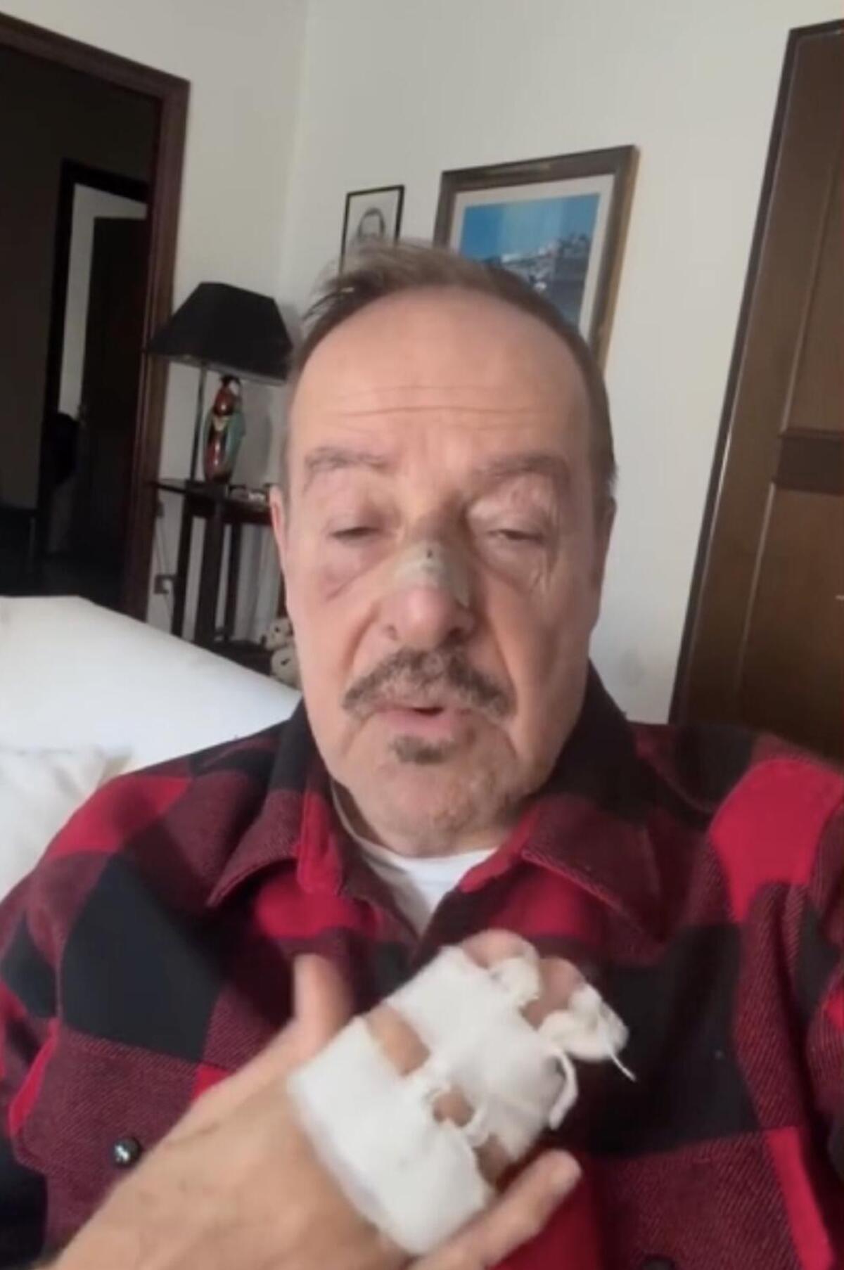 L'attore Massimo Lopez investito da un pirata della strada - News - Moto.it